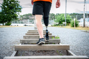 Professional – Fillauer Website